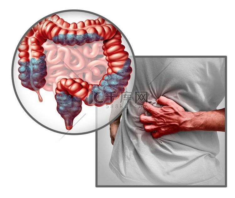 便秘解剖学和便秘症状作为大便排便问题作为消化系统的肠道和直肠在白色上带有 3D 插图元素。高清摄影大图-千库网