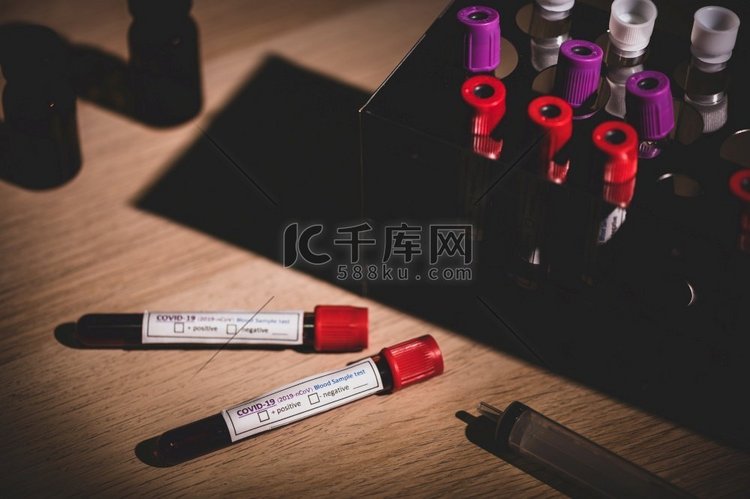 具有实验室背景的武汉 COVID-19 检测和血液检测实验室样本，用于诊断新的 Corona 病毒感染（新型 Corona 病毒病 2019 ...