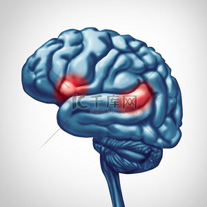 disorder，brain，disorder，anatomy高清摄影大图-千库网