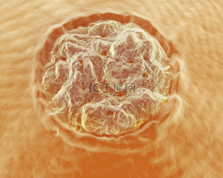 Plantar Wart Up-Close高清摄影大图-千库网