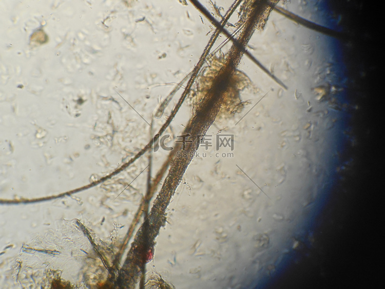 猫毛癣菌犬小孢子菌，显微镜高清摄影大图-千库网