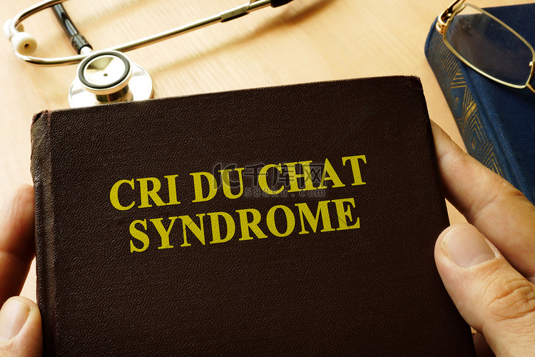书名为 Cri Du Chat 综合症。高清摄影大图-千库网