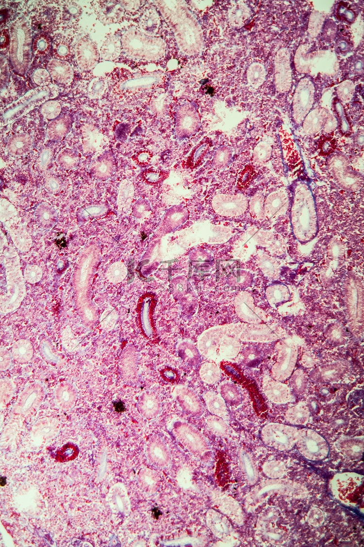 派克肾横截面 100x高清摄影大图-千库网