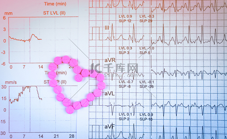 EKG 或 ECG（心电图）图形报告纸。 高清摄影大图-千库网
