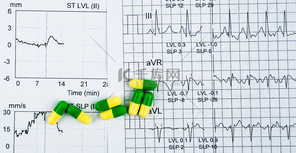 EKG 或 ECG（心电图）图形报告纸。 高清摄影大图-千库网
