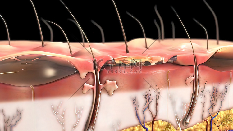 人体皮肤严重烧伤高清摄影大图-千库网