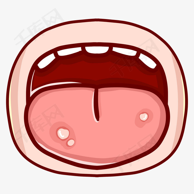 口腔溃疡上火溃烂素材图片免费下载-千库网