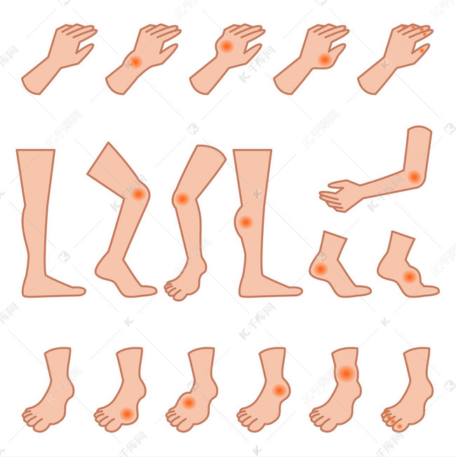 Limbs of gout素材图片免费下载-千库网